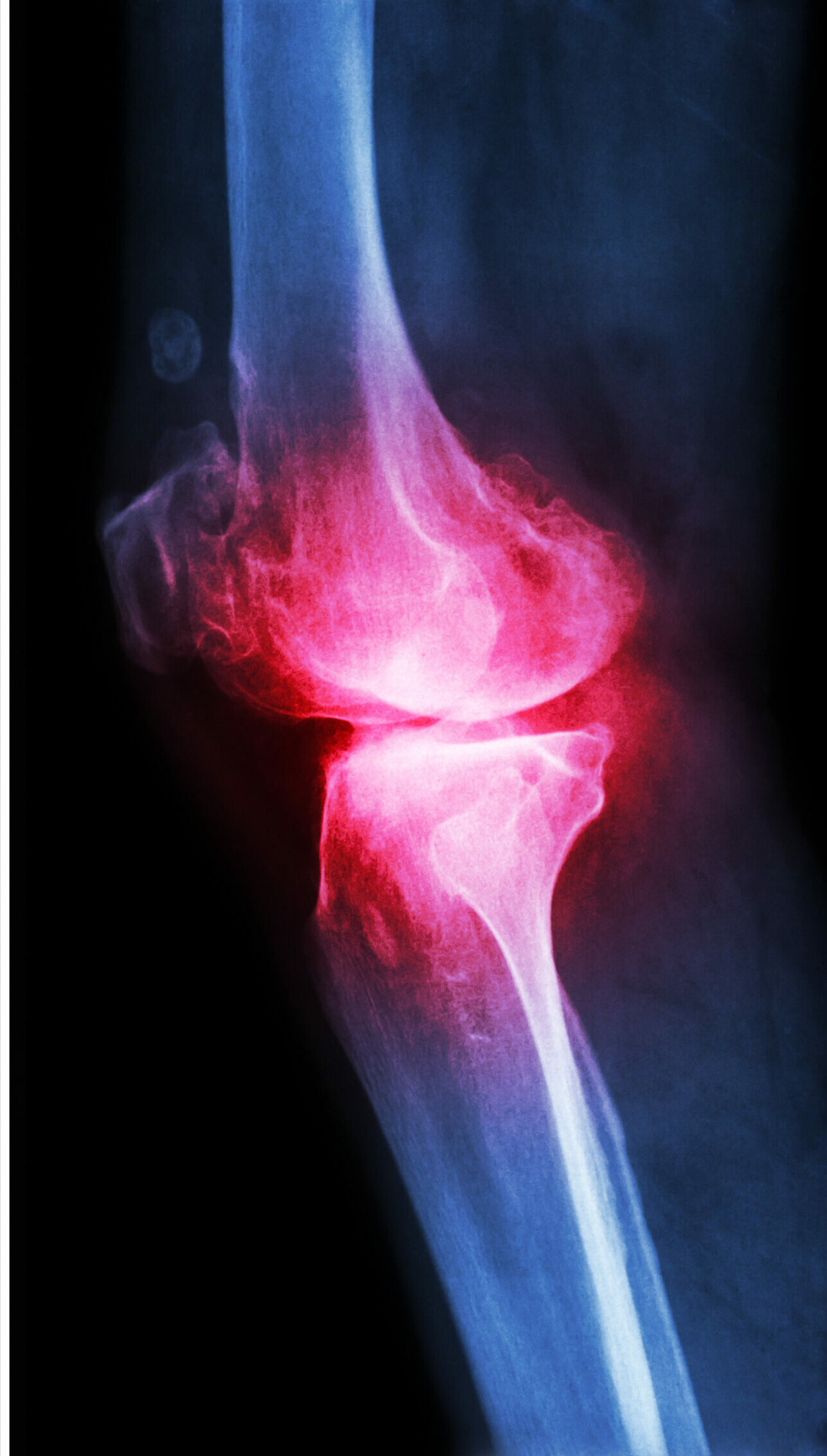 Dokter Jens De Vos | Knie